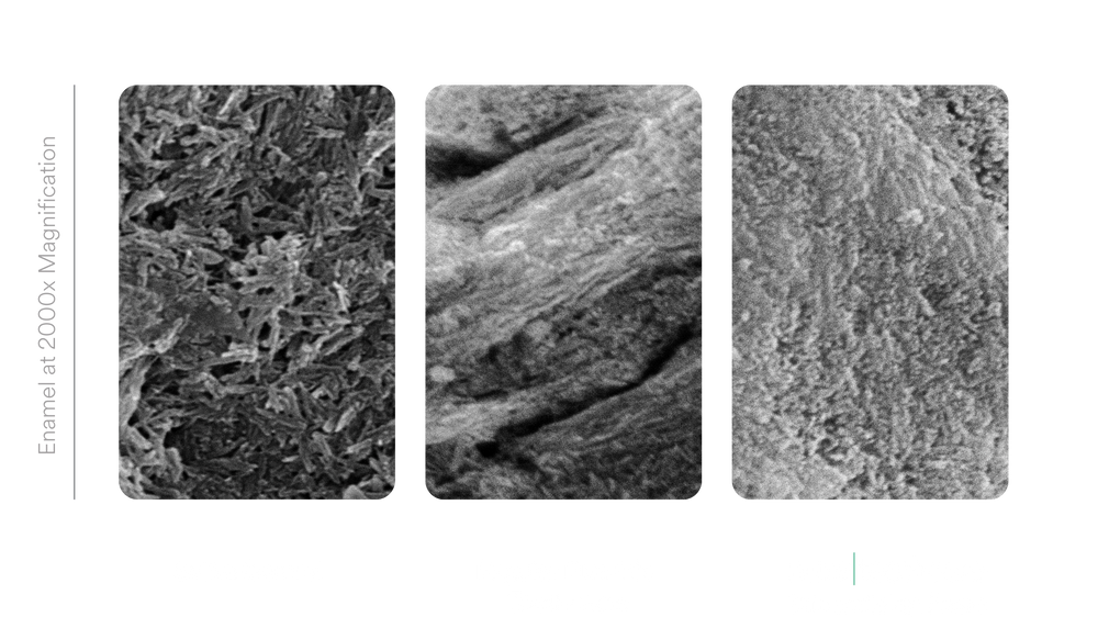 Nura Teethcare – Built by Science, Proven to Repair