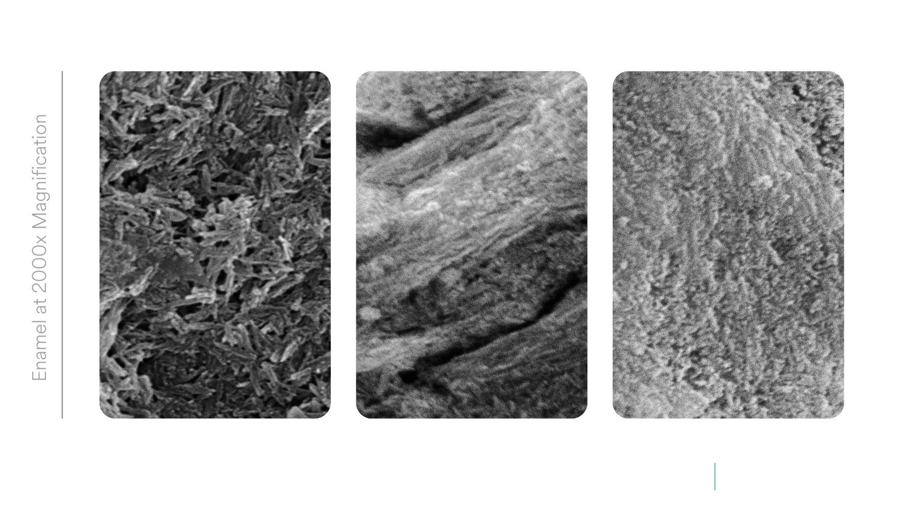 Nura Teethcare – Built by Science, Proven to Repair